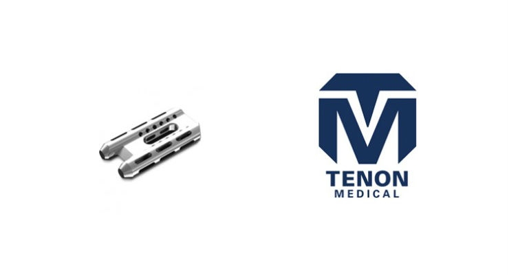 FDA OKs Tenon Medical's Catamaran Sacroiliac Joint Fusion System - ODT