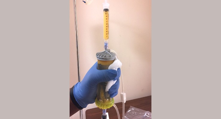 Lipogems Raises €12.5 Million to Accelerate Expansion in Knee ...