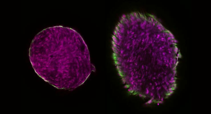 An Engineered Cartilage Template to Heal Broken Bones - ODT