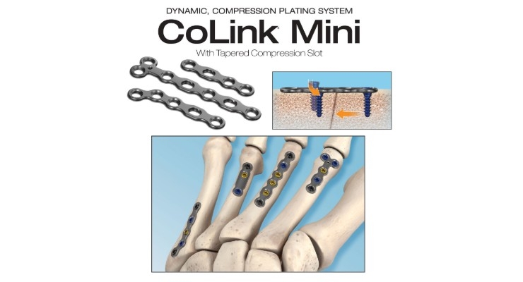 In2Bones Launches CoLink Mini Plating System - ODT