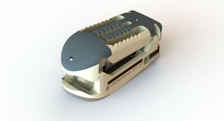 First Procedures with Spinal Elements' Expandable Interbody Implant - ODT