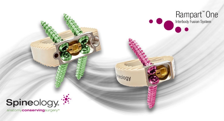 FDA OKs Spineology's Rampart One Standard ALIF Device for Stand-Alone ...