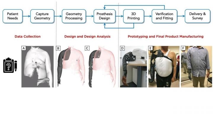Novel 3D Printed Non-Metallic Self-Locking Prosthetic Arm Developed - ODT