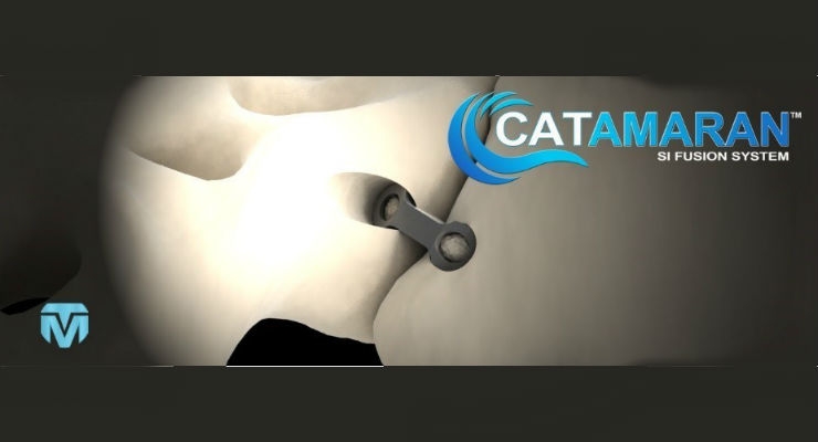 Clinical Study Shows Lower Back Pain Reduced With Tenon Medical's SIJ ...