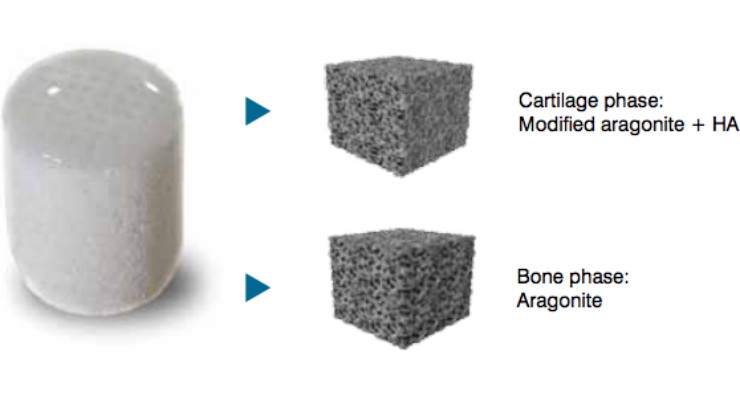 CartiHeal's Agili-C Implant for Joint Surface Lesions Treatment Wins ...