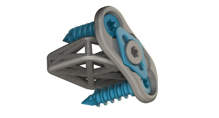FDA Clears 4WEB Medical's New Integrated Cervical Plate - ODT
