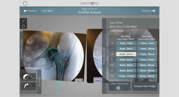 DePuy Synthes & JointPoint to Co-Market Hip Navigation System - ODT