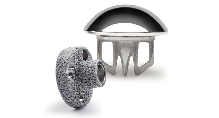 Shouldering Growth: An Examination of the Extremities Implant Sector - ODT