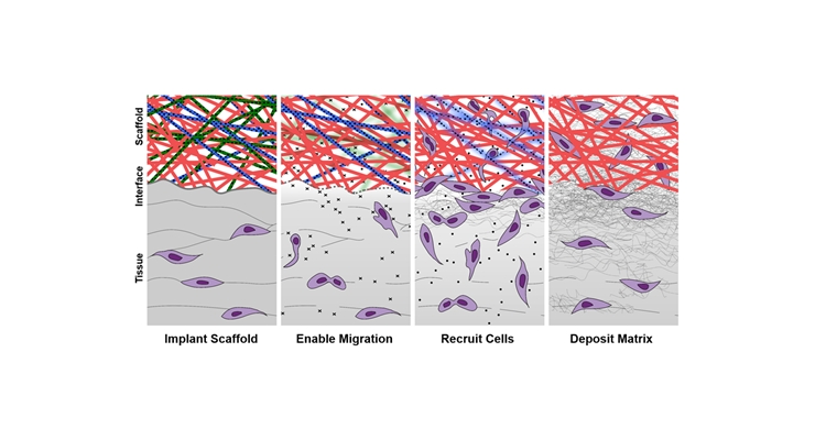 Tissue Engineering to Improve Meniscus Repair - ODT