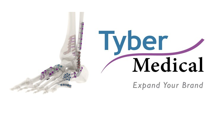 Tyber Medical Receives FDA Clearance for Expanded Line of Anatomical ...
