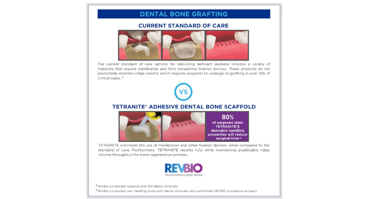 NIH Grant Allocated to RevBio for Dental Adhesive Bone Scaffold Product ...