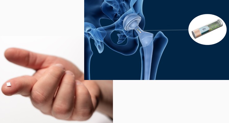 Solid-State Batteries Unlock the Full Potential of Smart Implants - ODT