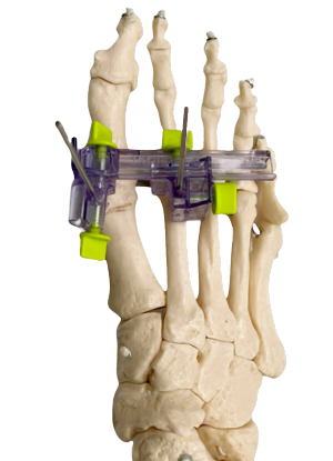 Hot Prospects in the Orthopedic Device Industry