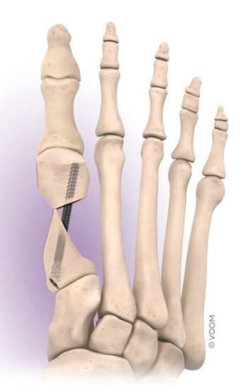 Hot Prospects in the Orthopedic Device Industry