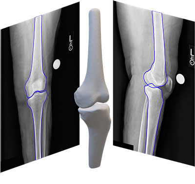 Illuminating the Path to Surgical Planning with X-Rays