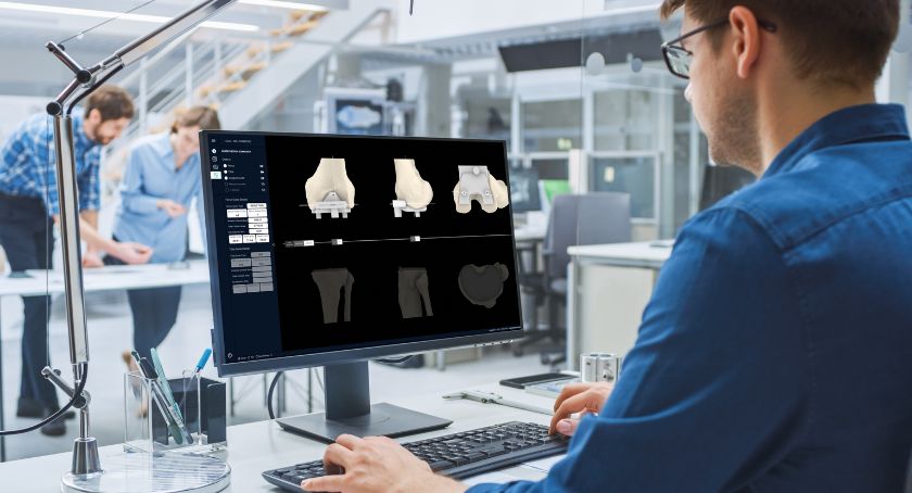 Enabling Patient-Specific Implants at Scale