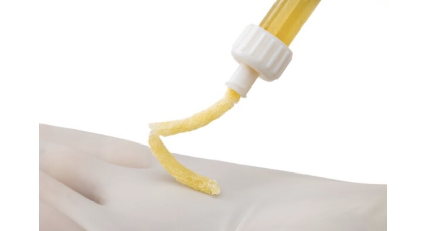 LifeNet Health Launches Bone Void Solution, PliaFX Flo - ODT