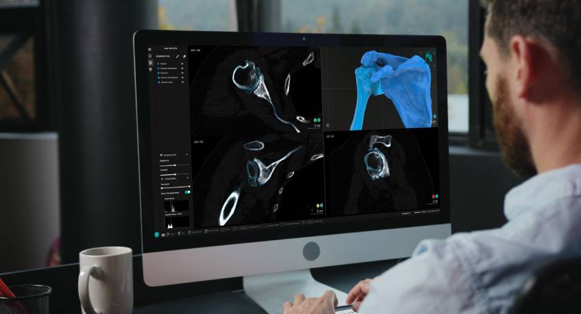 Driving the Next Evolution in Patient-Specific Orthopedic Solutions ...