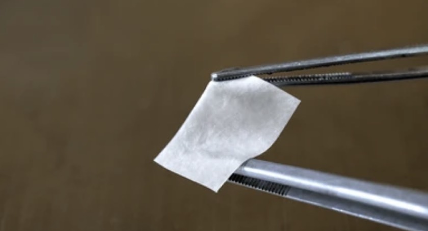 Exploring the Global Landscape of Synthetic Bone Graft Substitutes - ODT