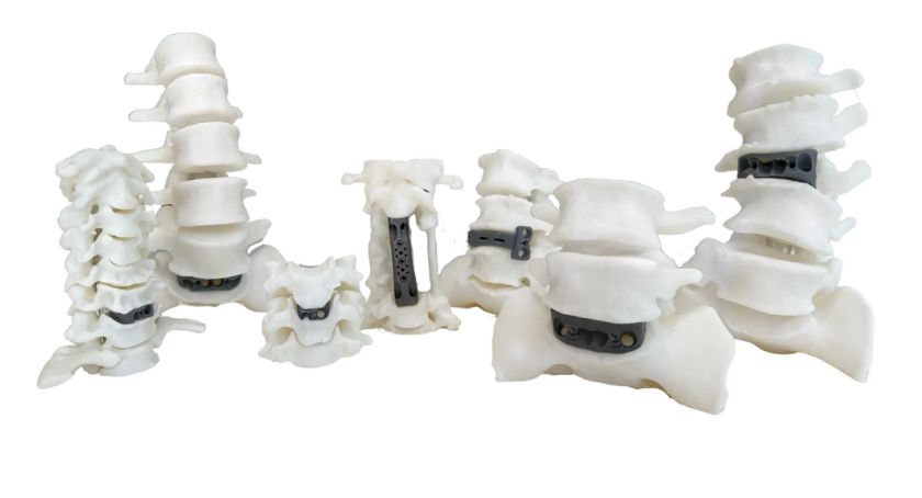 Navigating 3D Technologies: A Success Blueprint for Medical Device ...