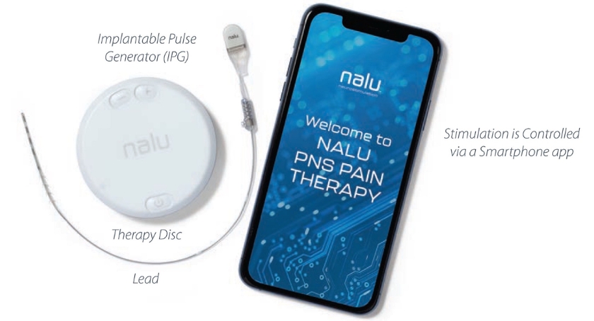 Nalu's Real-World Permanent PNS Data Backs Use