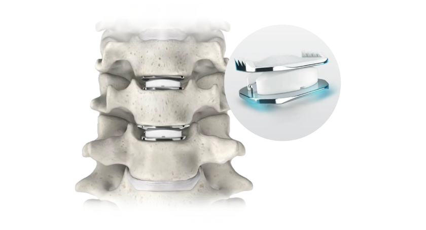 Highridge Medical to Introduce activL Lumbar Disc - ODT