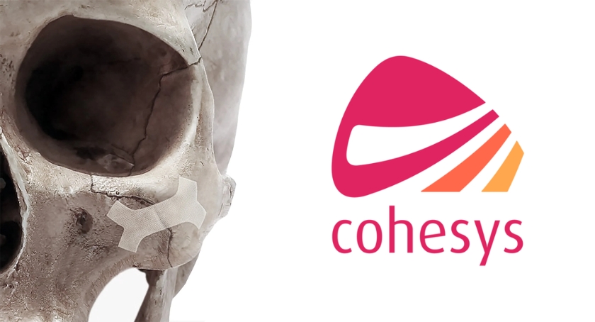 Cohesys Reports First-in-Human for BoneTape
