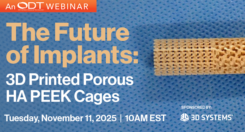 The Future of Implants: 3D Printed Porous HA PEEK Cages - ODT