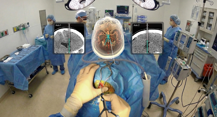 FDA Clears Augmented Reality Navigation in Neurosurgery - ODT