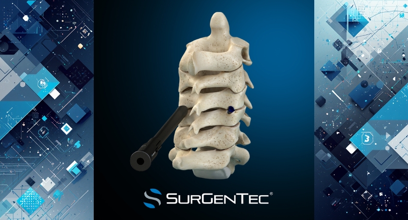 FDA OKs SurGenTec's ION-C Facet Fixation System