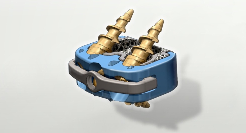 Lincotek Wins FDA Nod for Cervical Implant System